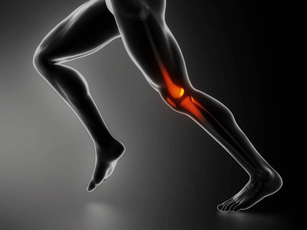 Lesiones de rodilla más comunes en corredores y cómo tratarlas